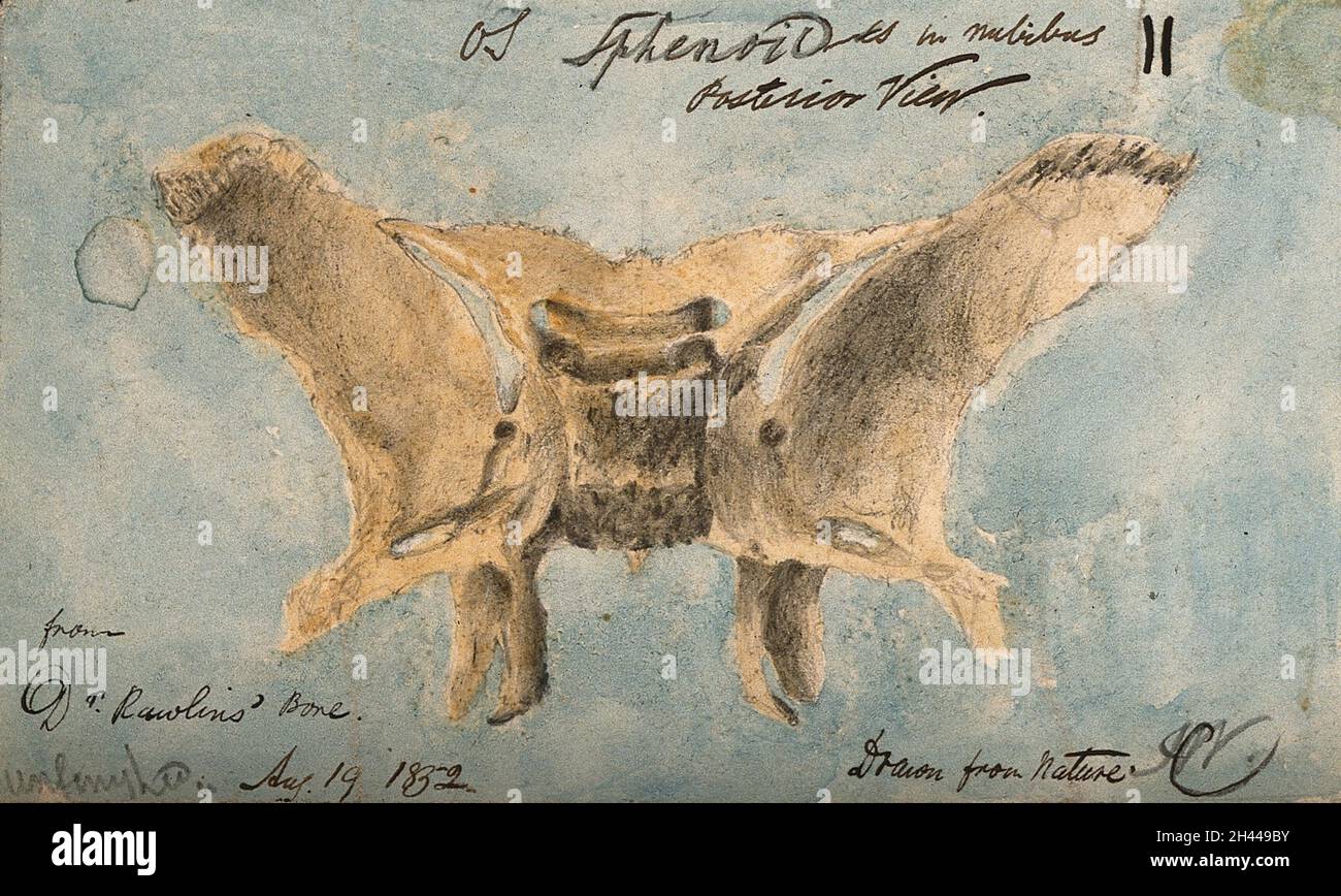 The sphenoid bone, shown from behind. Pencil and watercolour drawing by ...