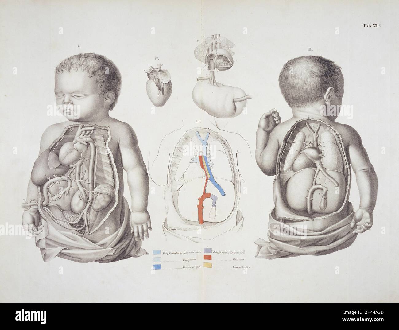 View of internal organs of of infant Stock Photo - Alamy