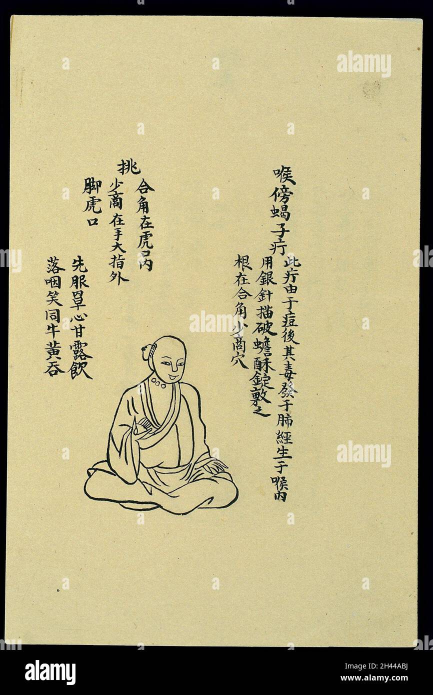 C19 Chinese ink drawing: Boils - scorpion boil in the throat Stock ...