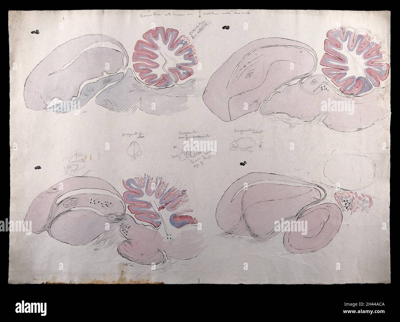 Brain of a sparrow with a tumour on the cerebellum: figures showing ...