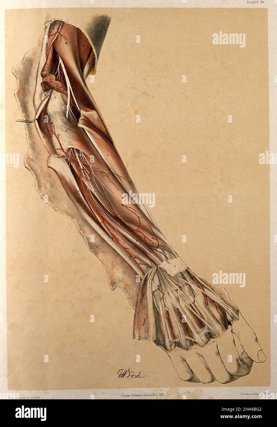 Dissection of the back of the fore-arm and hand. Lithograph by G.H ...