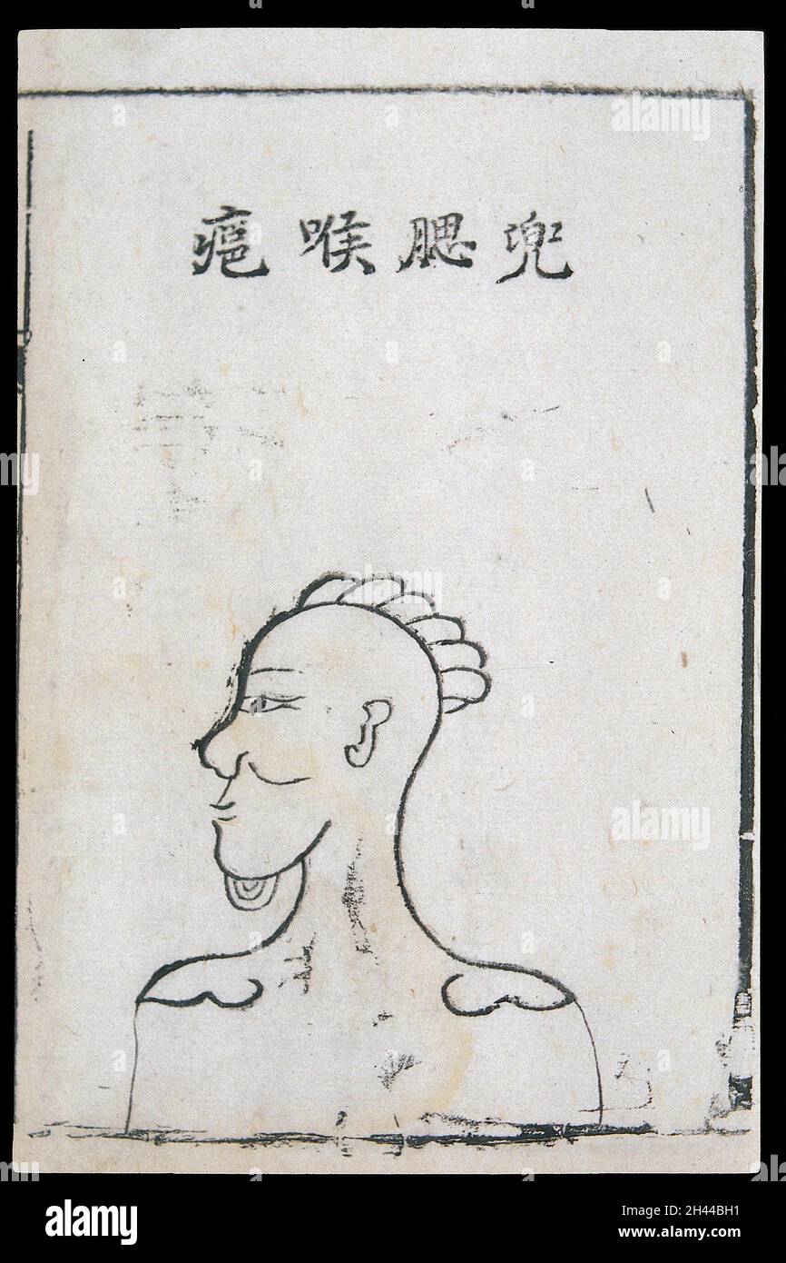 C18 Chinese woodcut: Cheek-pouch throat abscess Stock Photo - Alamy