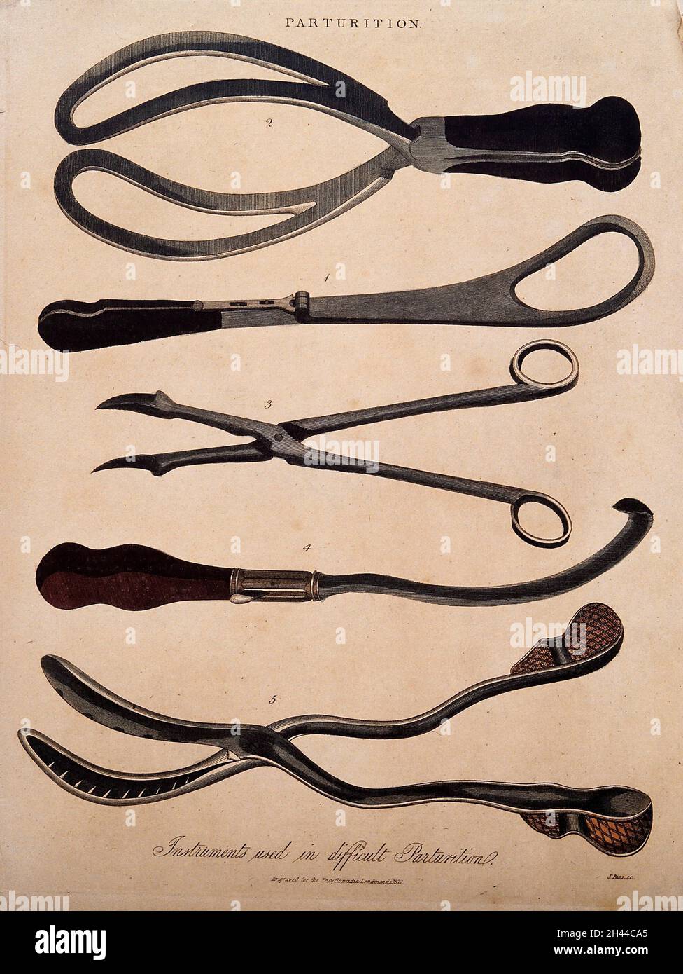 Surgical instruments for use in difficult childbirth procedures: five ...