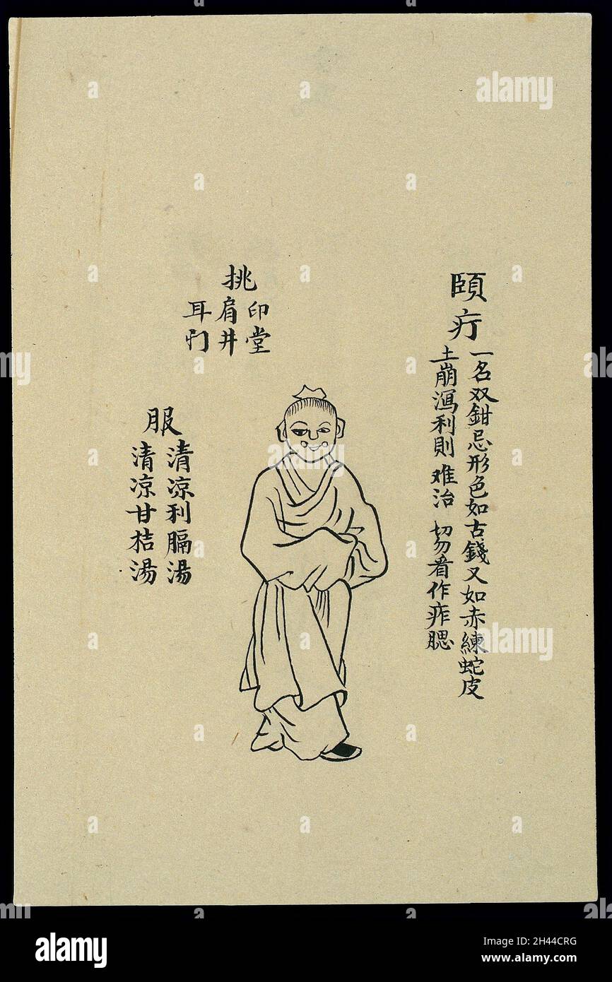 C19 Chinese ink drawing: Boils - boil on the lower cheek Stock Photo ...