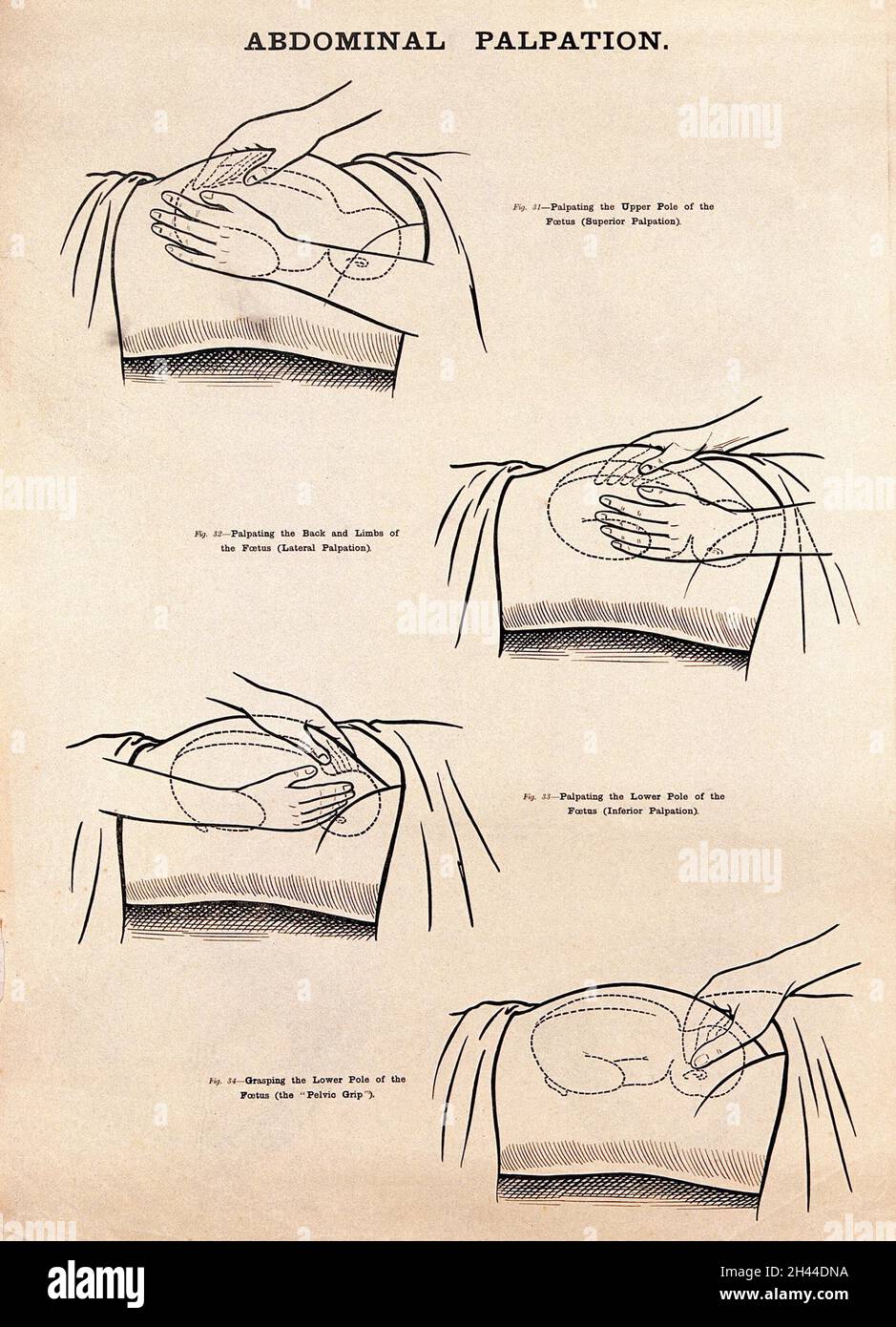 Abdominal palpation hi-res stock photography and images - Alamy