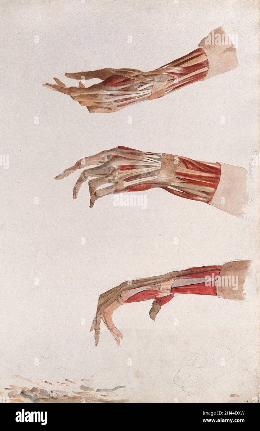 Three dissections of the left hand and wrist, showing the muscles and ...