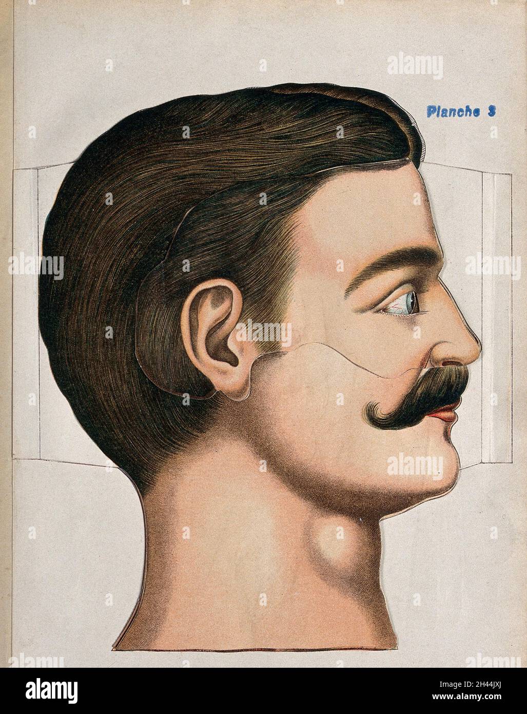 Anatomical cut out of a man's face and neck in profile. Lithograph ...