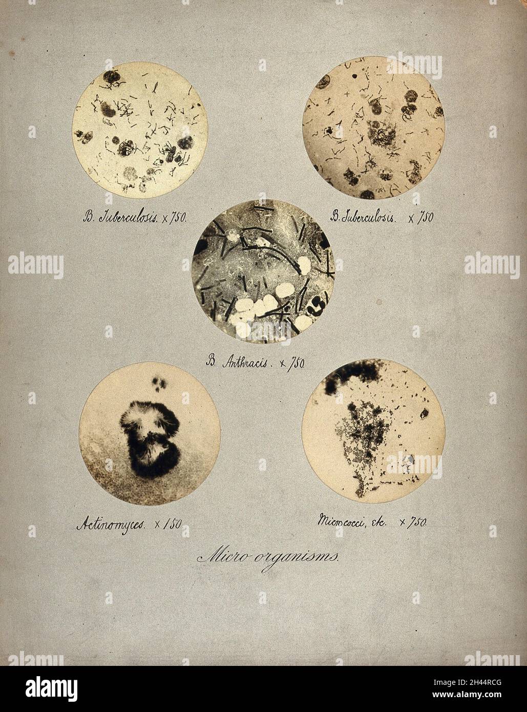 Tuberculosis and anthrax bacilli, actinomyces and micrococci, seen ...