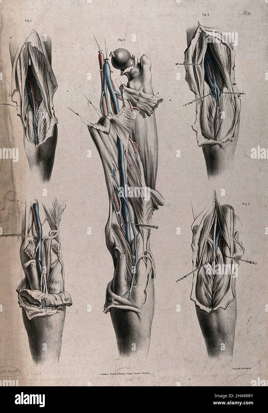 The circulatory system: dissections of the leg, with arteries and veins ...