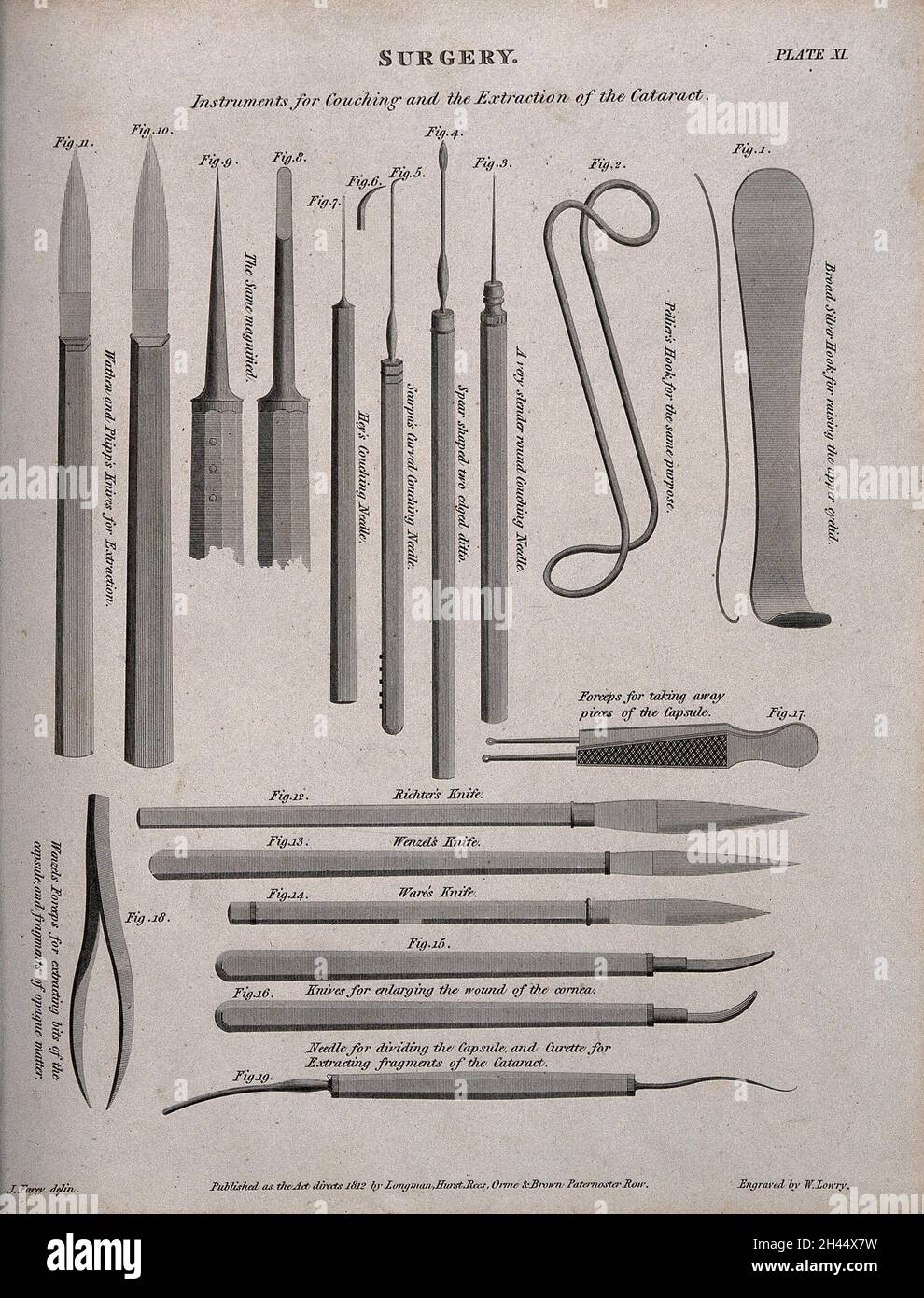 Surgical instruments for the extraction of cataracts. Engraving by W ...
