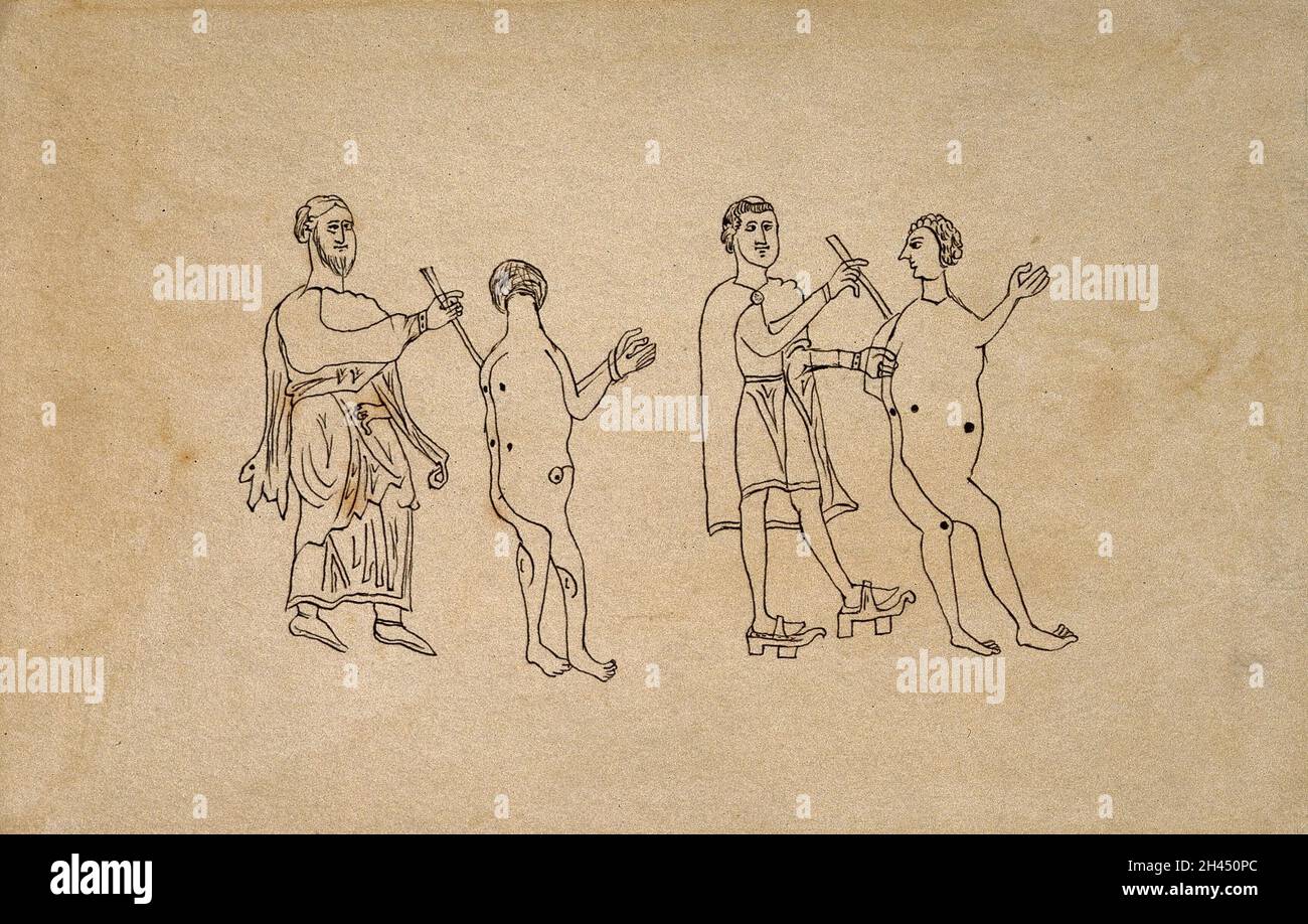 Two physicians applying the method of cauterisation to clearly defined ...