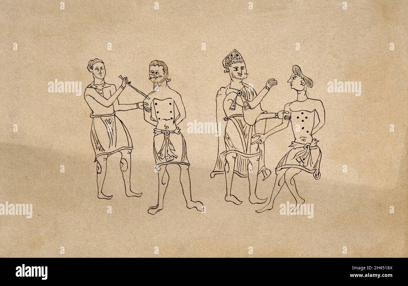 Two surgeons applying the method of cauterisation to clearly defined ...