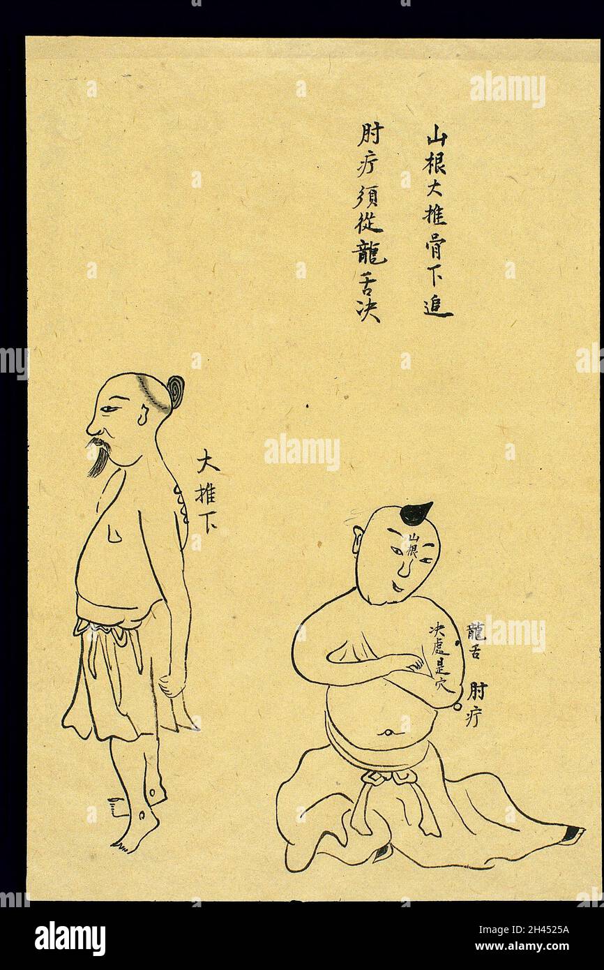 C19 Chinese ink drawing: 'Mountain root' and elbow boils Stock Photo ...