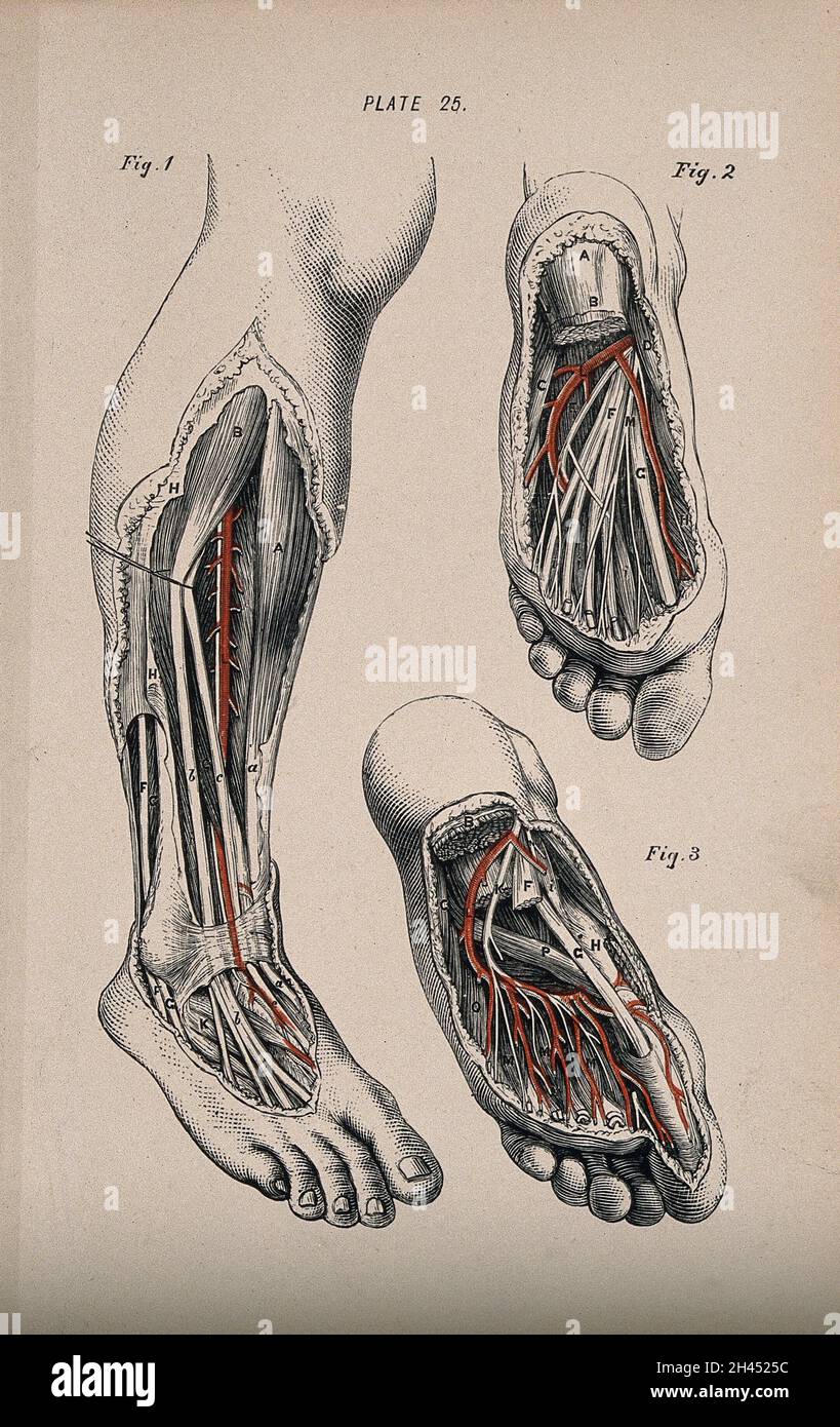 Dissection of the foot and lower leg: three figures, showing the ...
