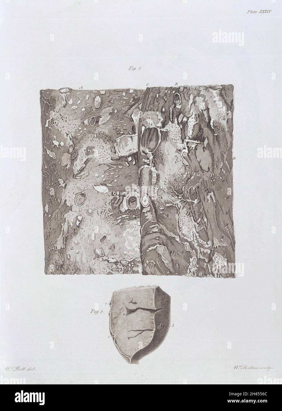 A part of a uterus at the 9th month of gestation Stock Photo - Alamy