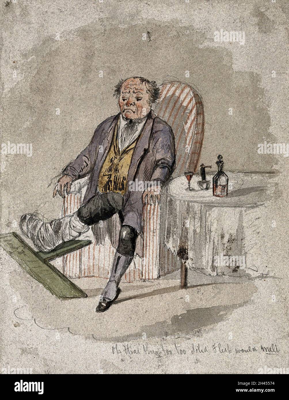 A seated gouty man with his bandaged leg on a gout stool. Coloured pencil drawing Stock Photo ...