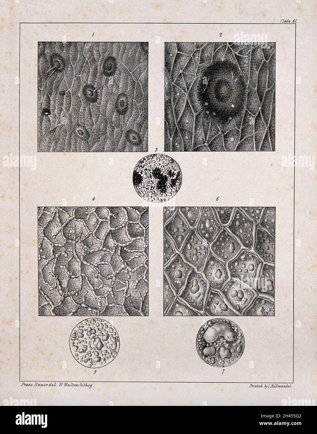 Several examples of skin disease. Lithograph by W. Walton after Franz ...