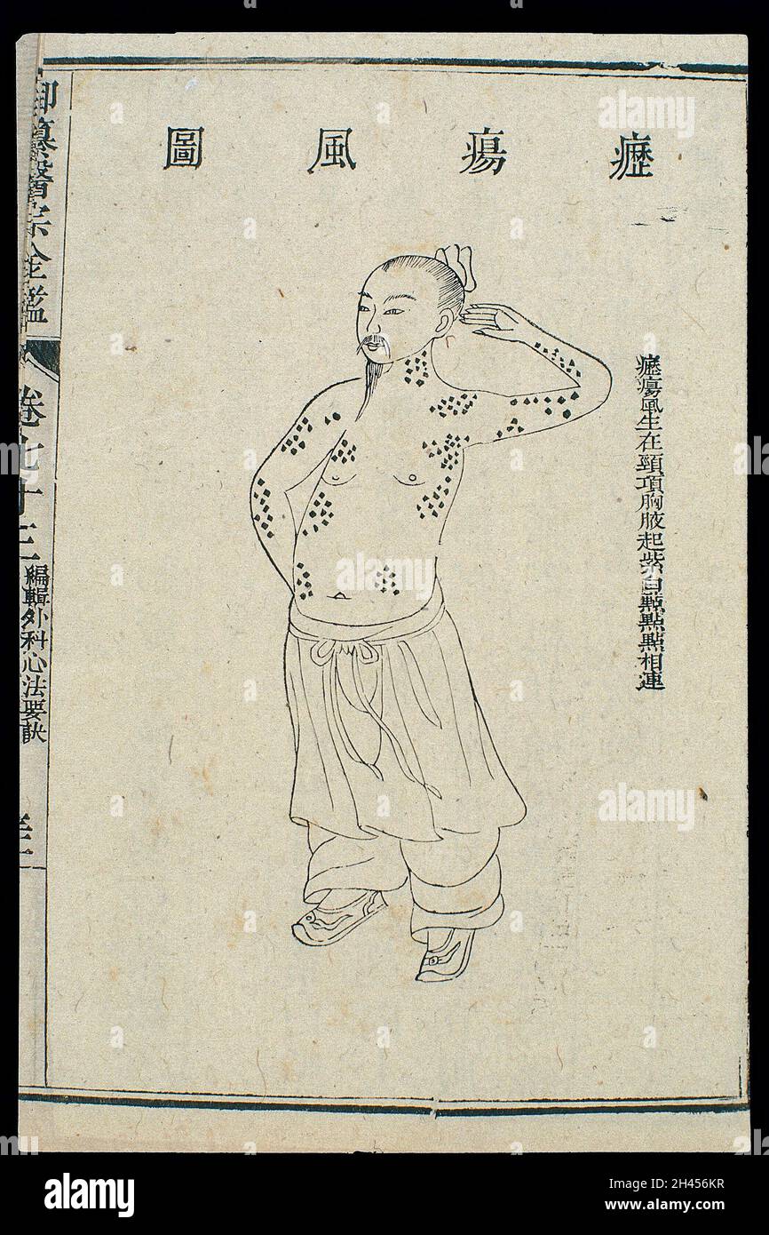 Chinese C18 woodcut: External medicine - 'Scrofulous ulcers' Stock ...