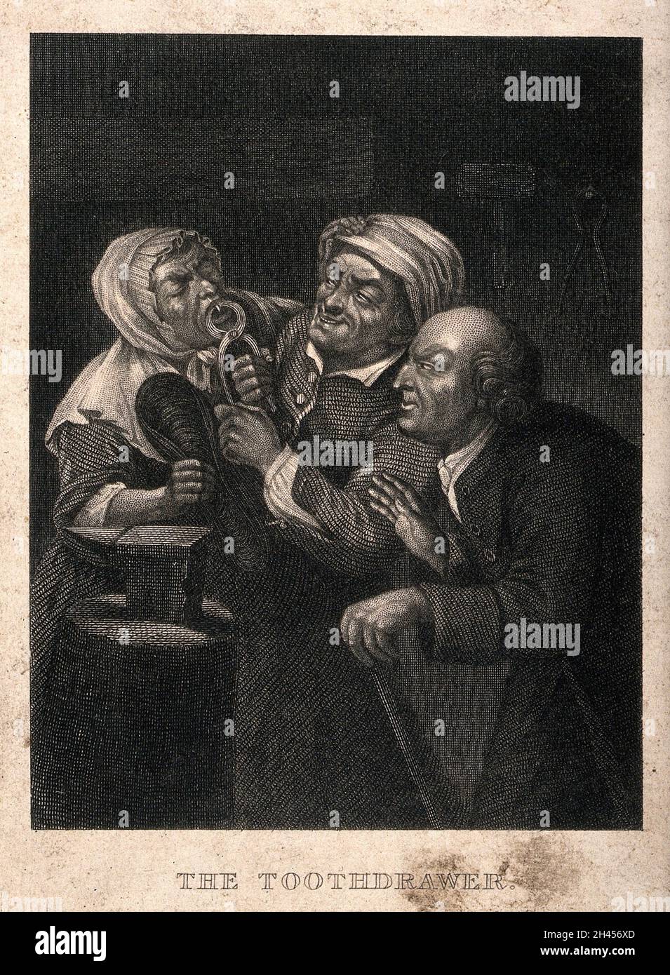 A rustic blacksmith turned tooth-drawer extracting a tooth from an ...