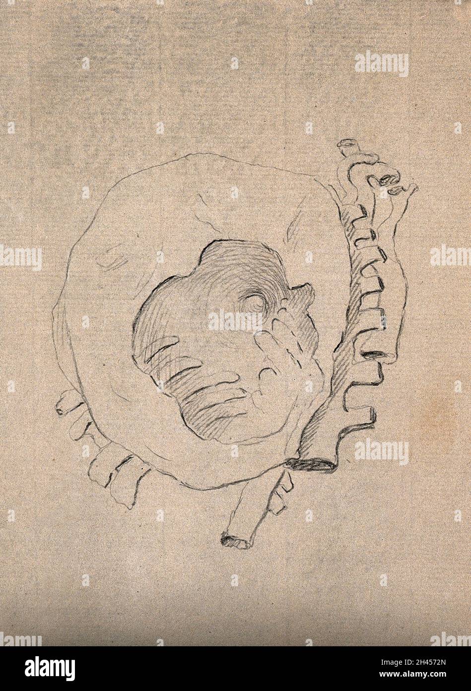 A diseased part of the body. Drawing Stock Photo - Alamy