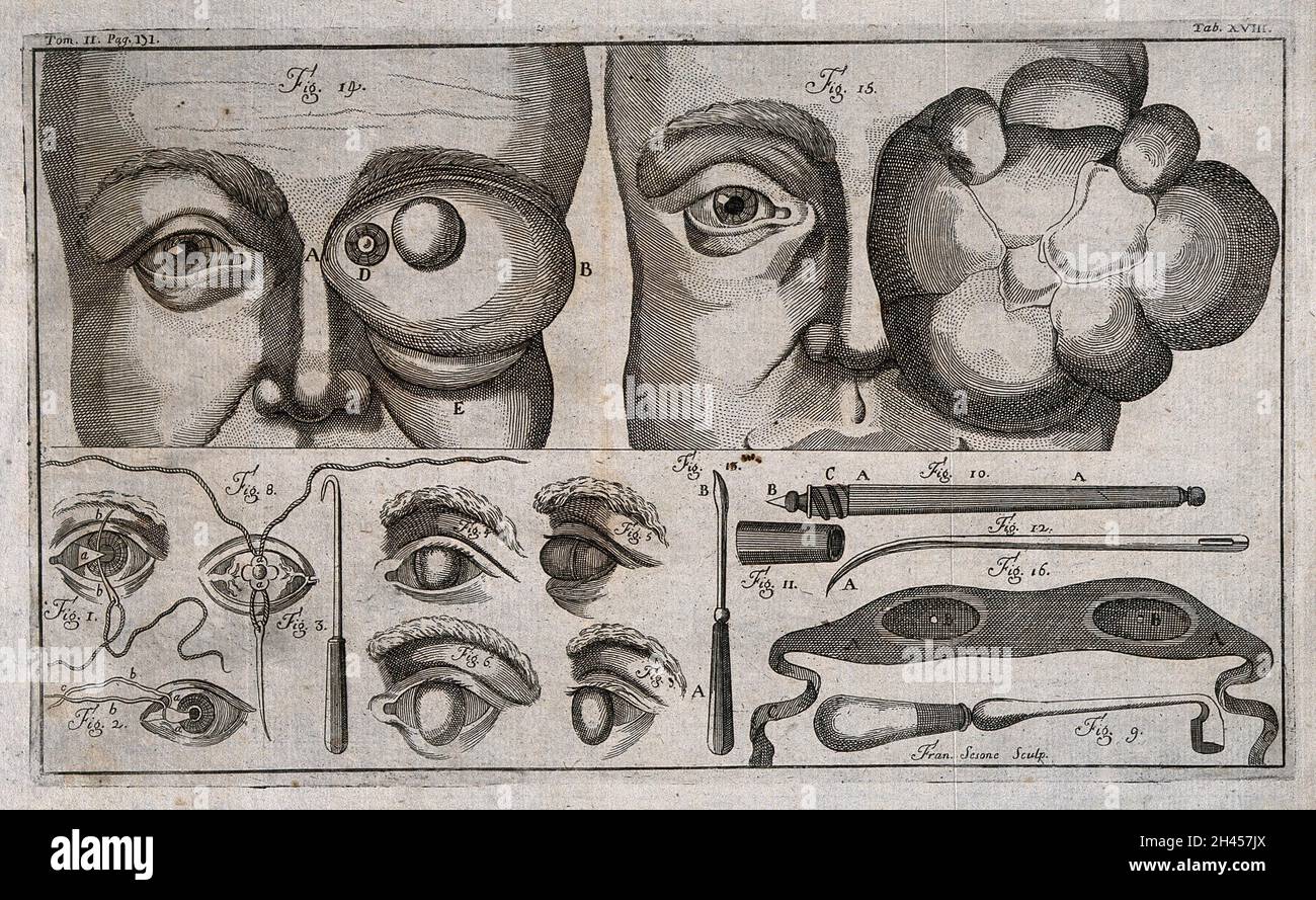 Eye treatment ophthalmology line hi-res stock photography and images ...