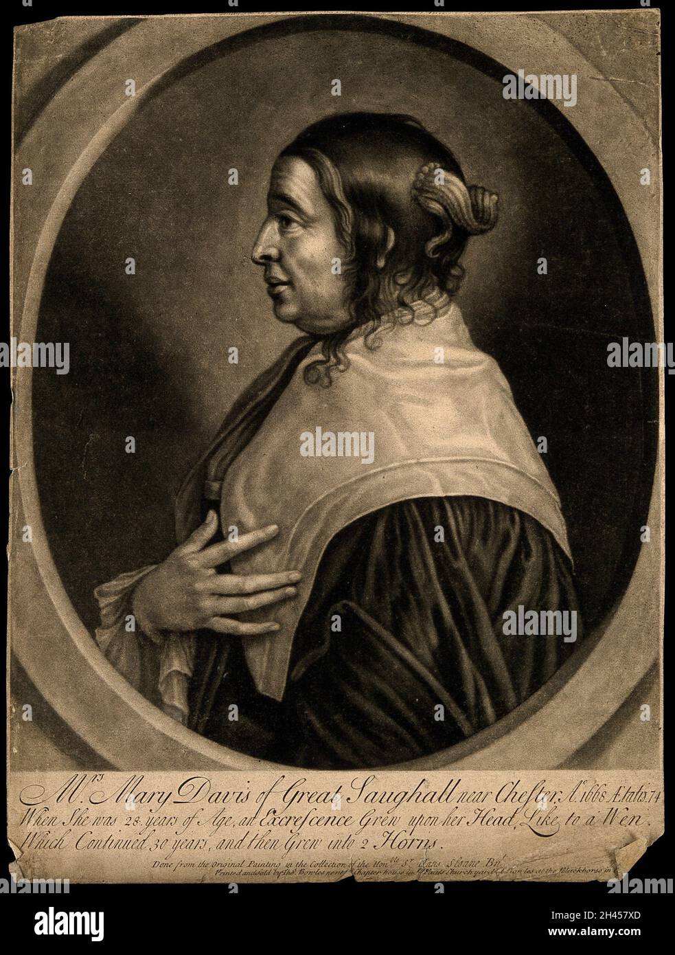 Mary Davis, a woman with horns, aged 74. Mezzotint Stock Photo - Alamy