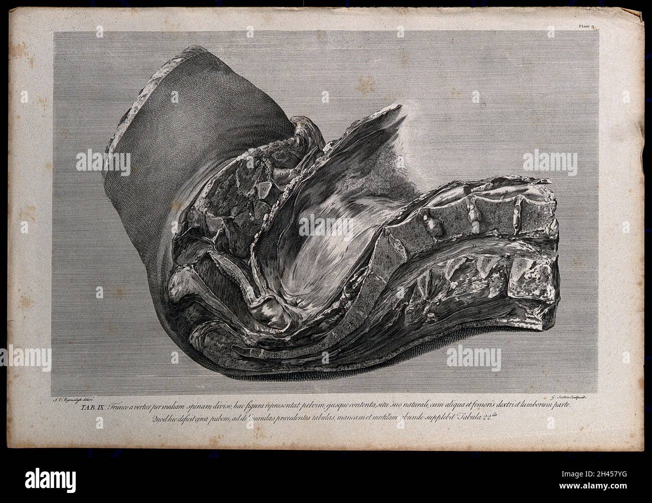 Section through the pelvis of a pregnant woman, showing the spine and ...