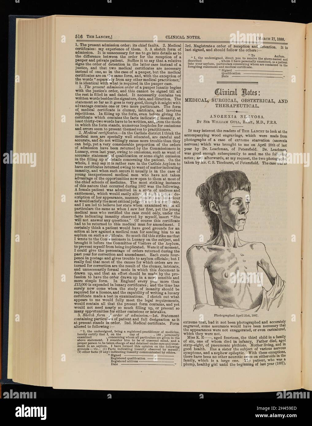 Miss treatment hi-res stock photography and images - Alamy