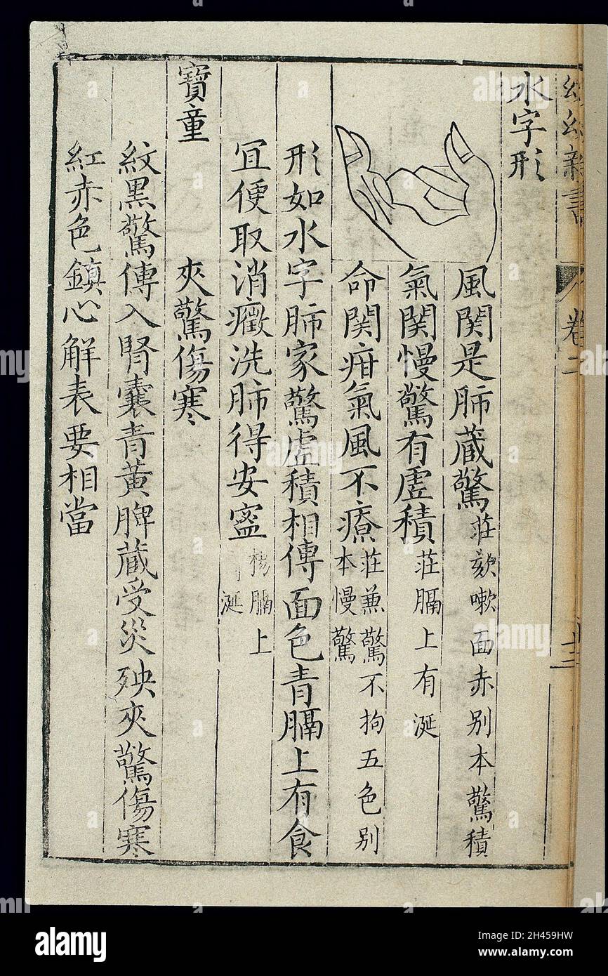 Paediatric finger diagnosis chart: 'Water Graph' vein pattern Stock ...