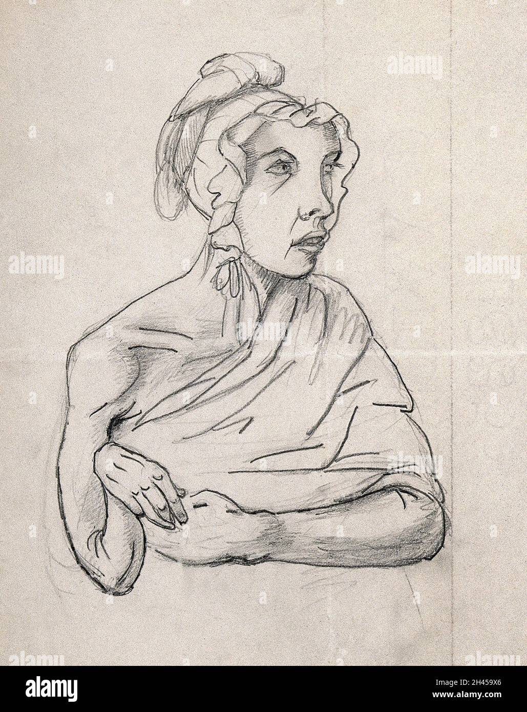 A woman with a deformed right hand and forearm. Drawing, c. 1825 ...