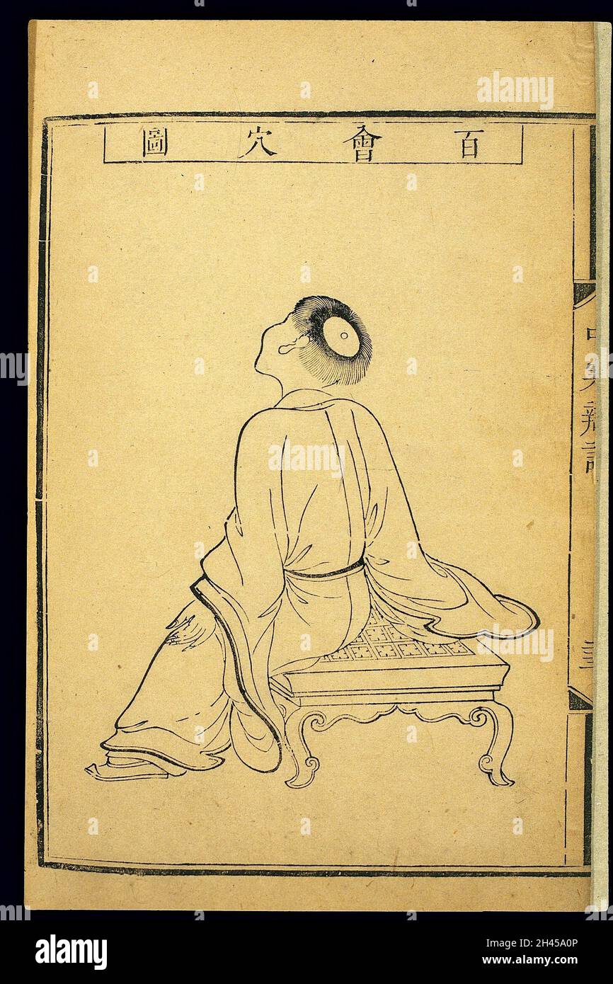 Acumoxa chart: Location of the baihui point, Chinese woodcut Stock ...