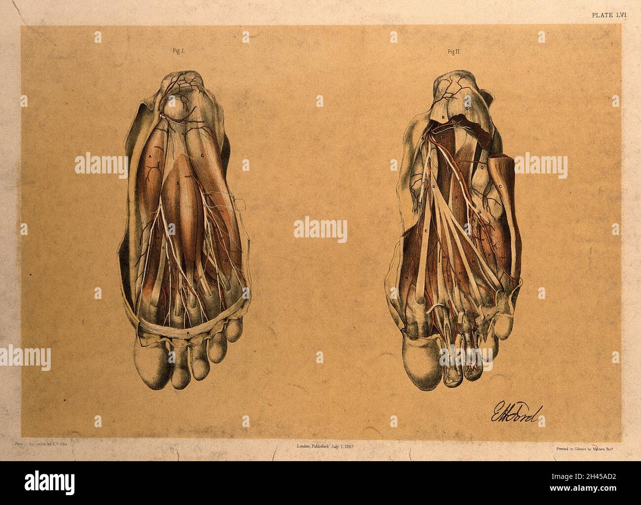 Dissections of the underside of the foot, showing the muscles and blood ...