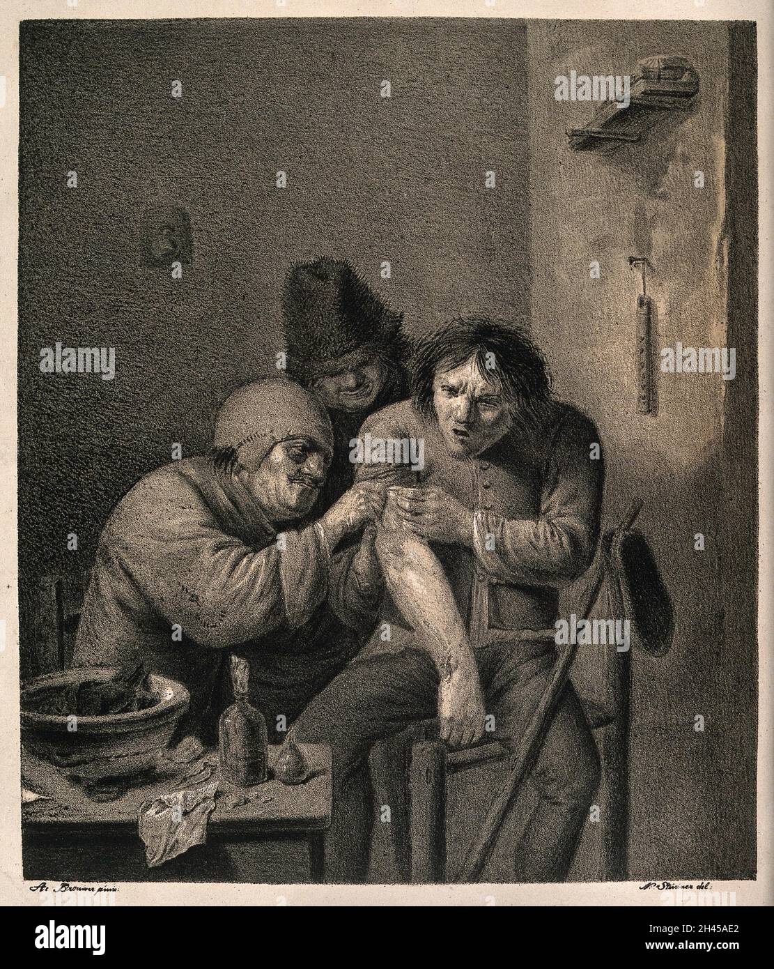 A surgeon dressing the wound of a grimacing patient. Lithograph by N ...