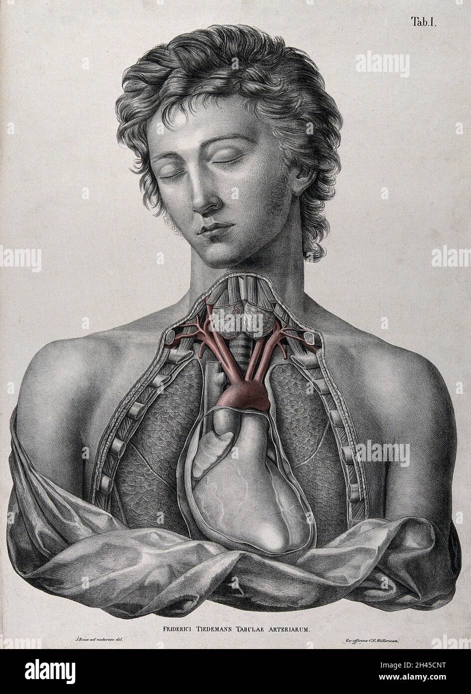 Partial dissection of the chest of a man, with arteries indicated in ...