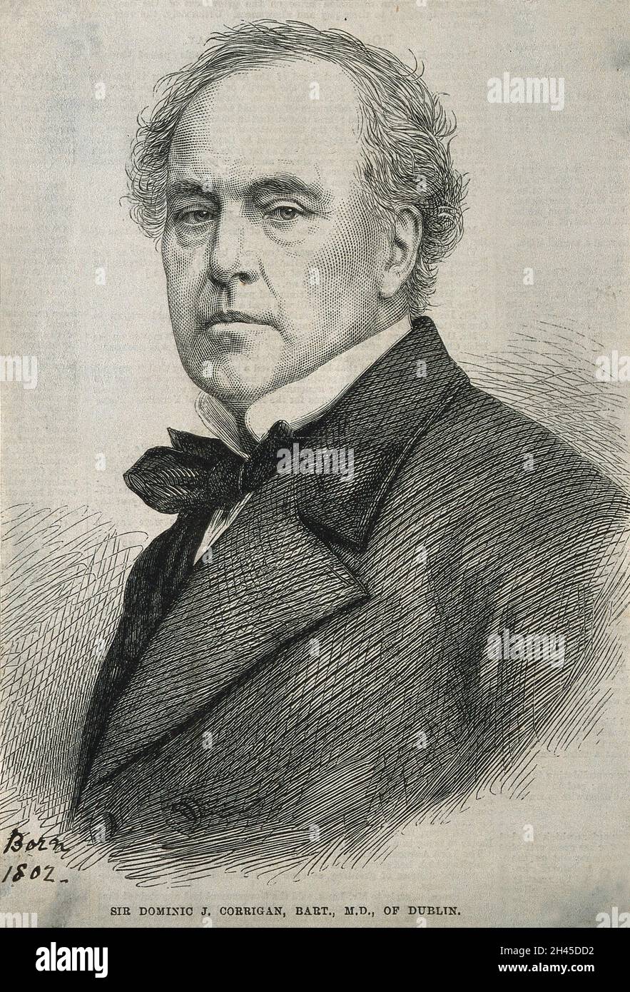 Sir Dominic John Corrigan. Wood engraving Stock Photo - Alamy