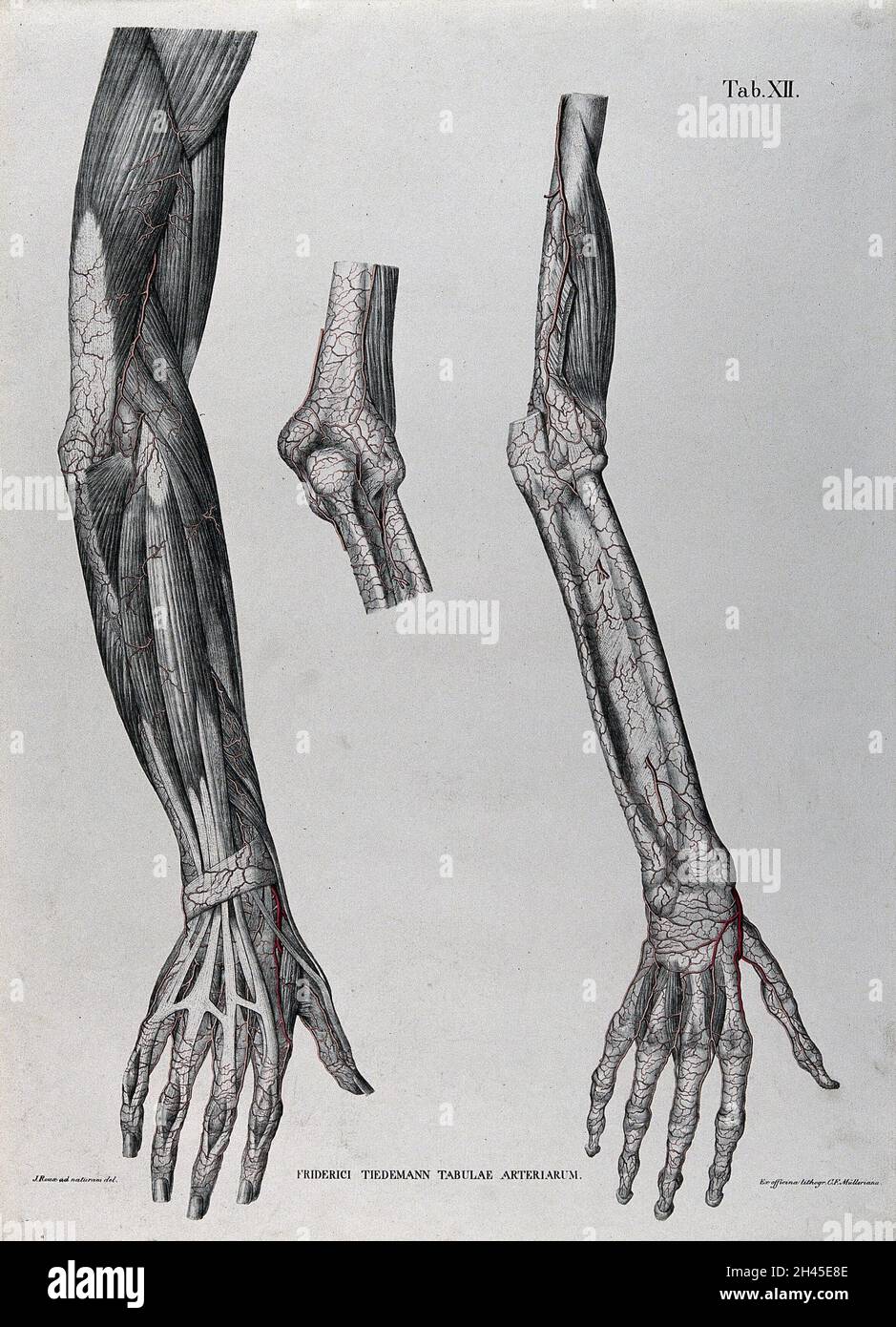 Dissections of the arm, hand and elbow joint; three figures, with the ...