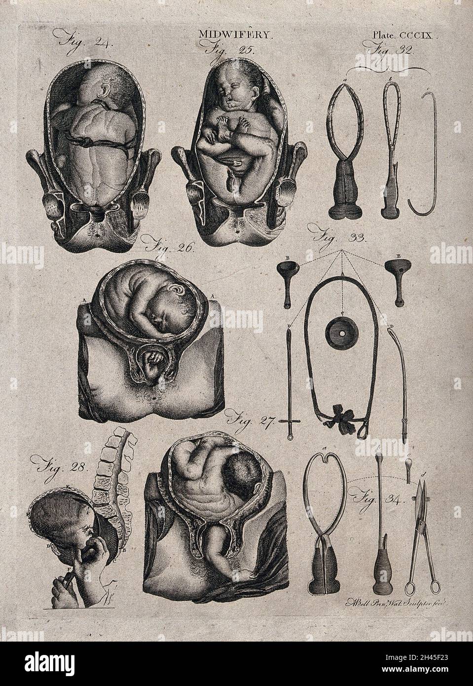 Eight diagrams illustrating difficult births and obstetrical ...