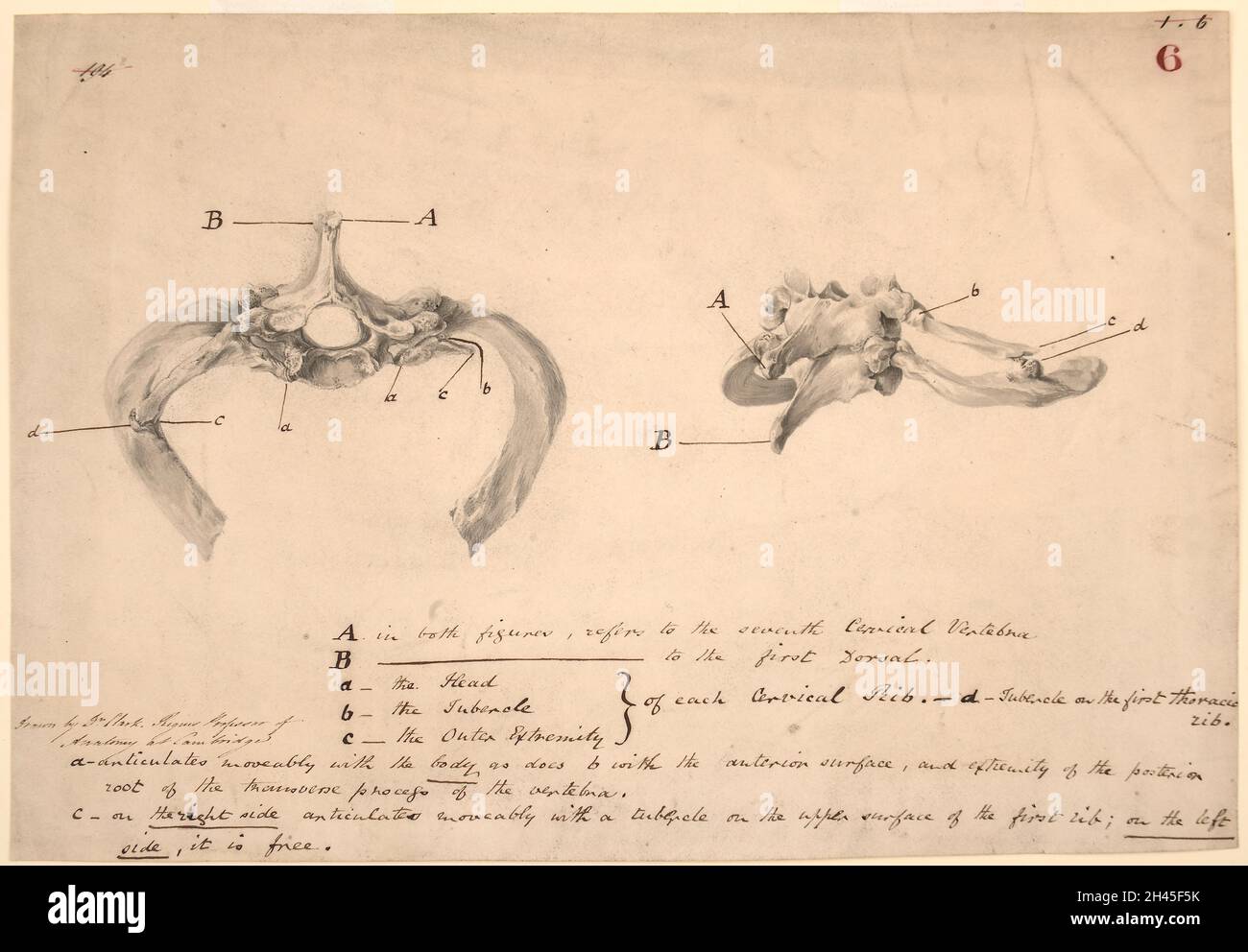 Unusually large cervical ribs on the seventh cervical vertebra Stock ...