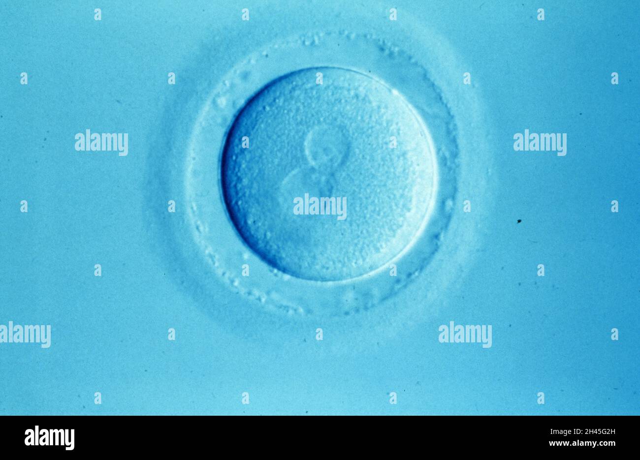 Newly fertilised human egg Stock Photo - Alamy