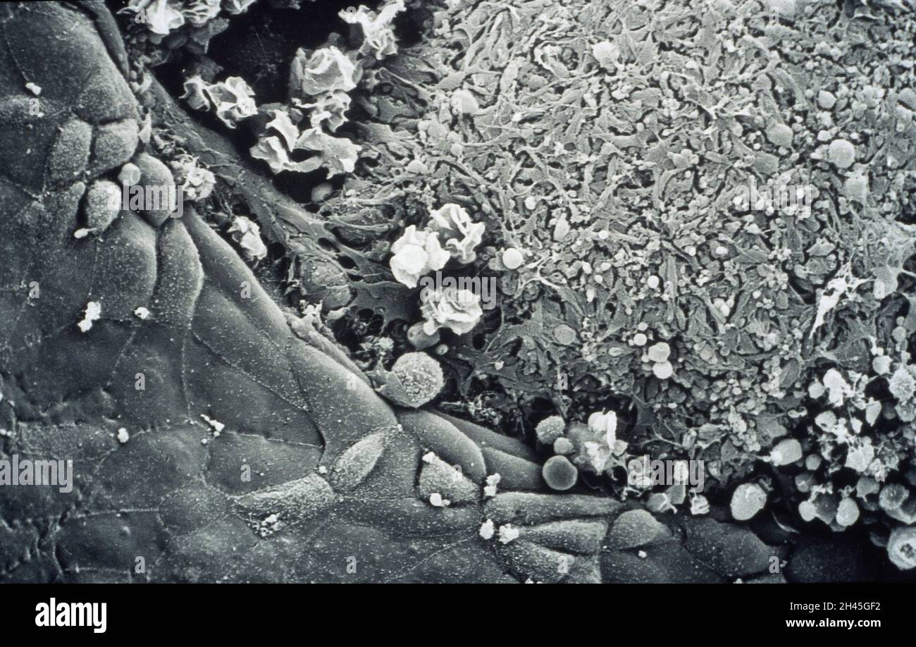 embryo wound healing SEM Stock Photo - Alamy