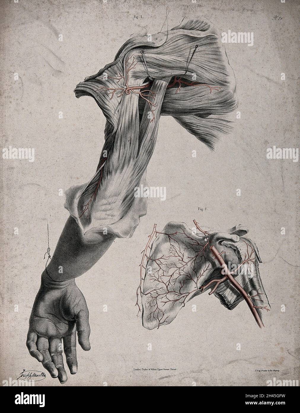 The circulatory system: dissection of the back of the upper arm and the ...