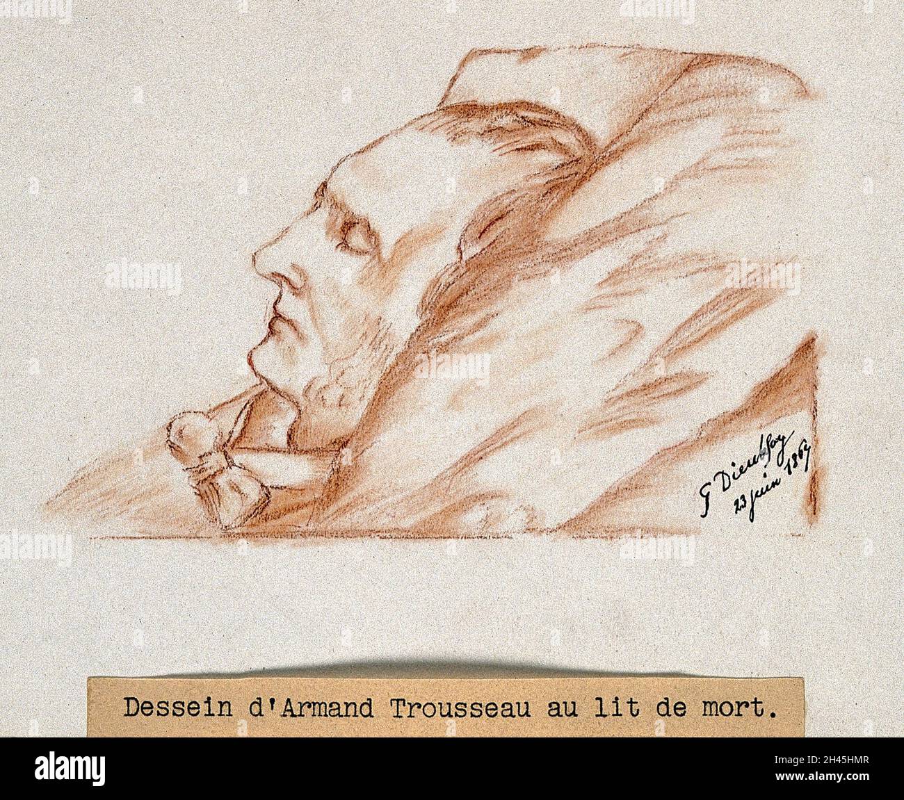 Armand Trousseau on his deathbed. Red chalk drawing by G. Dieulafoy ...