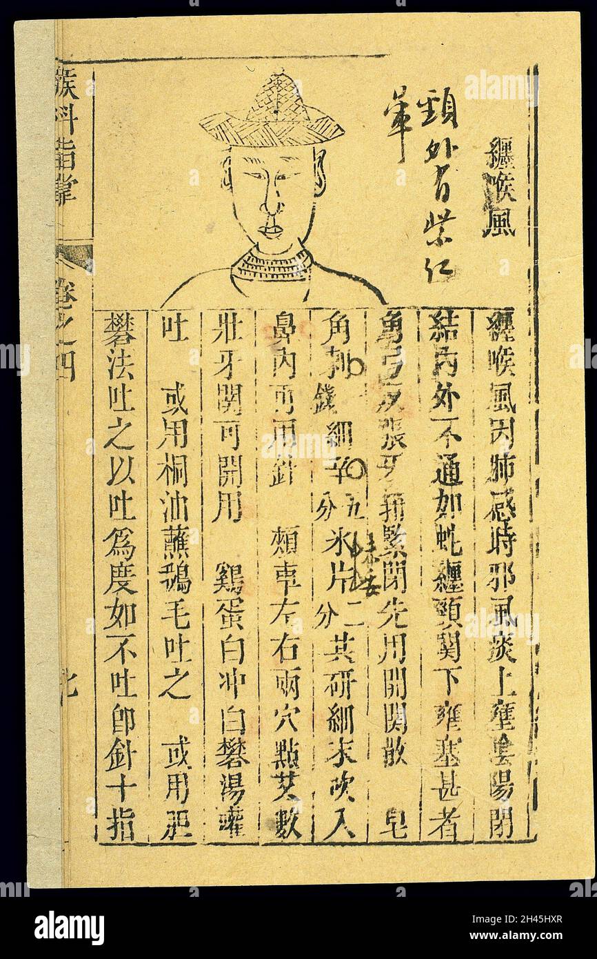 Chinese woodcut: Pathology of 'entwining throat wind' Stock Photo - Alamy