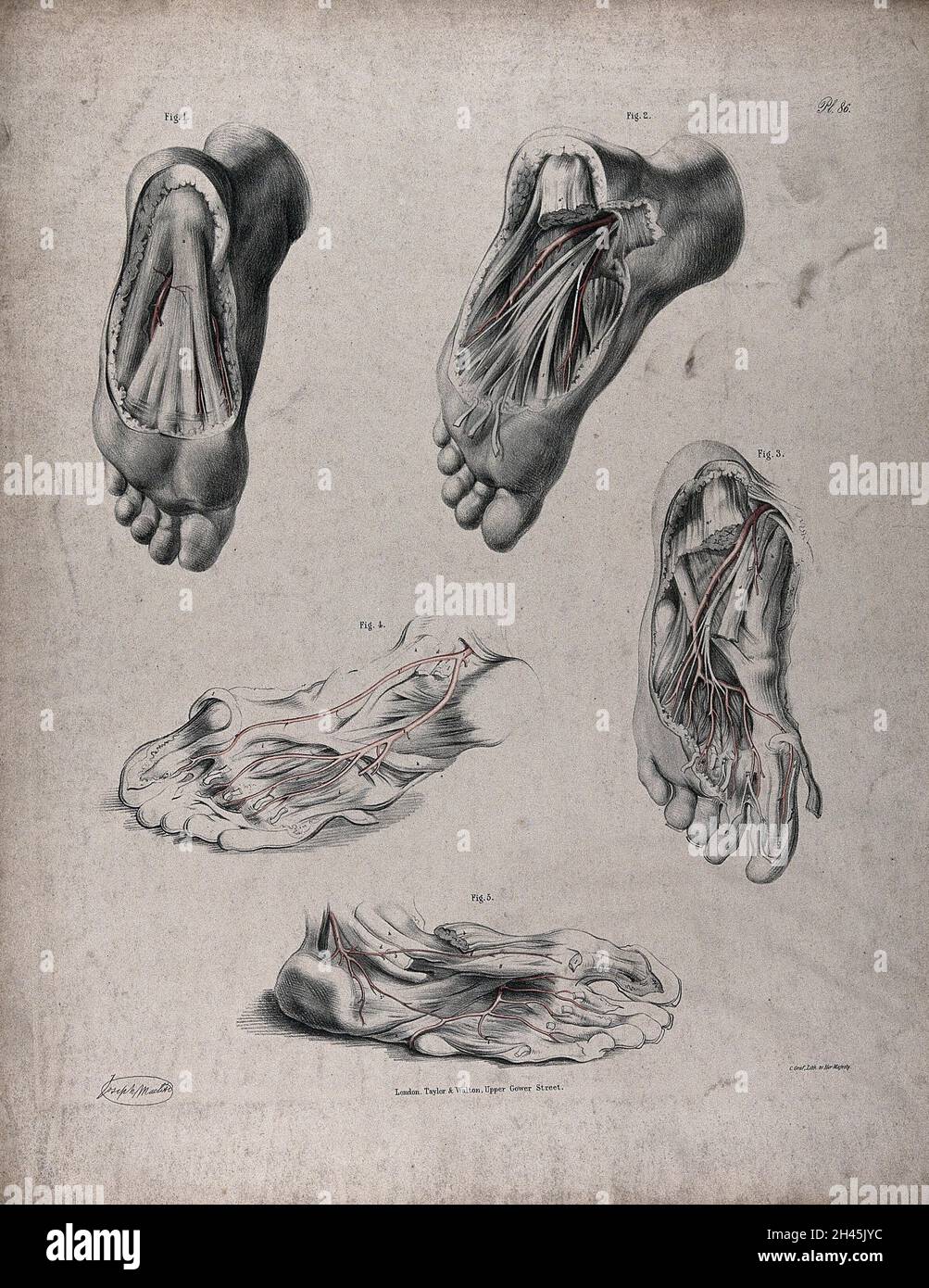 The circulatory system: dissections of the underside of the foot, with ...