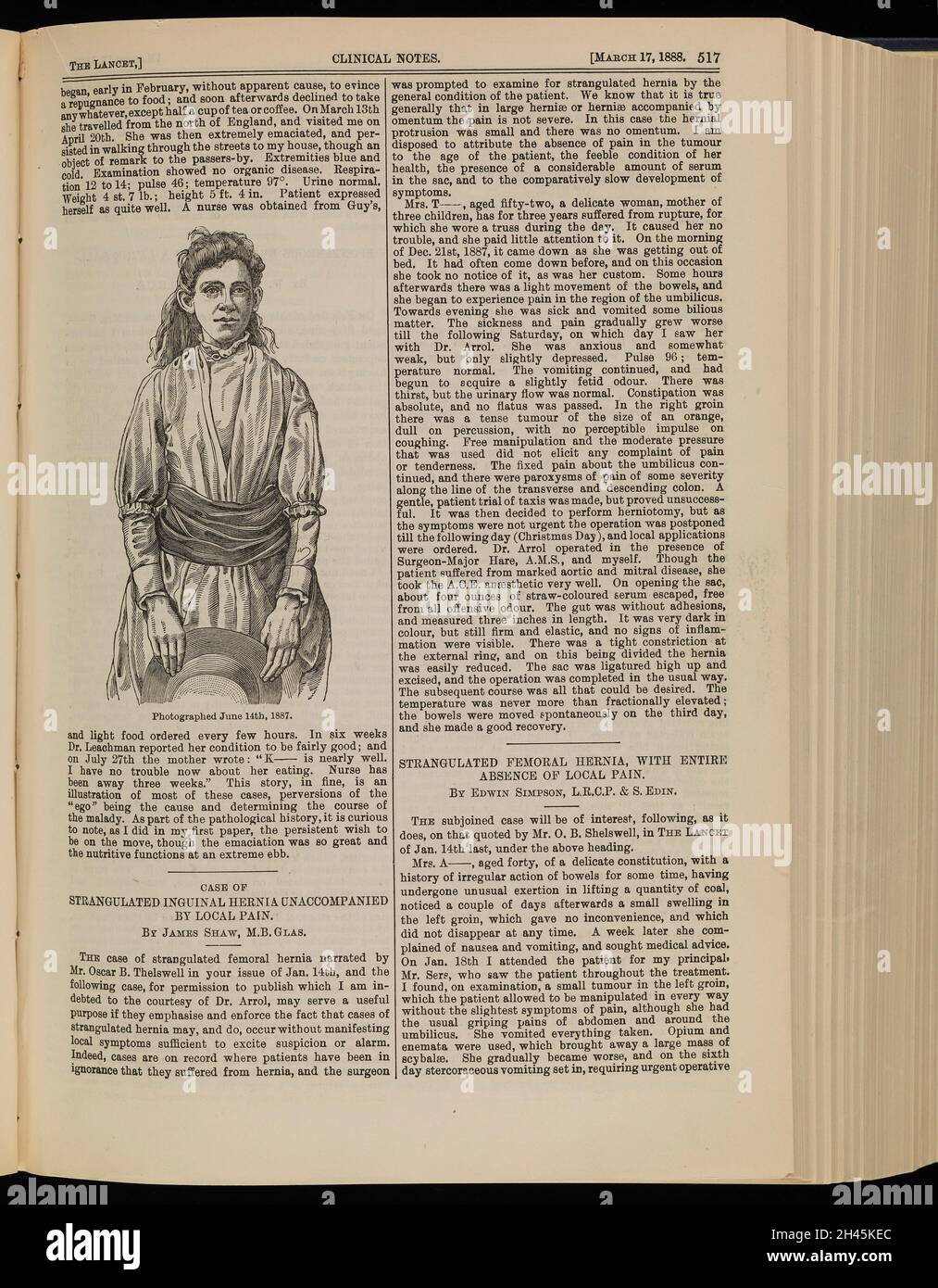 Miss treatment hi-res stock photography and images - Alamy