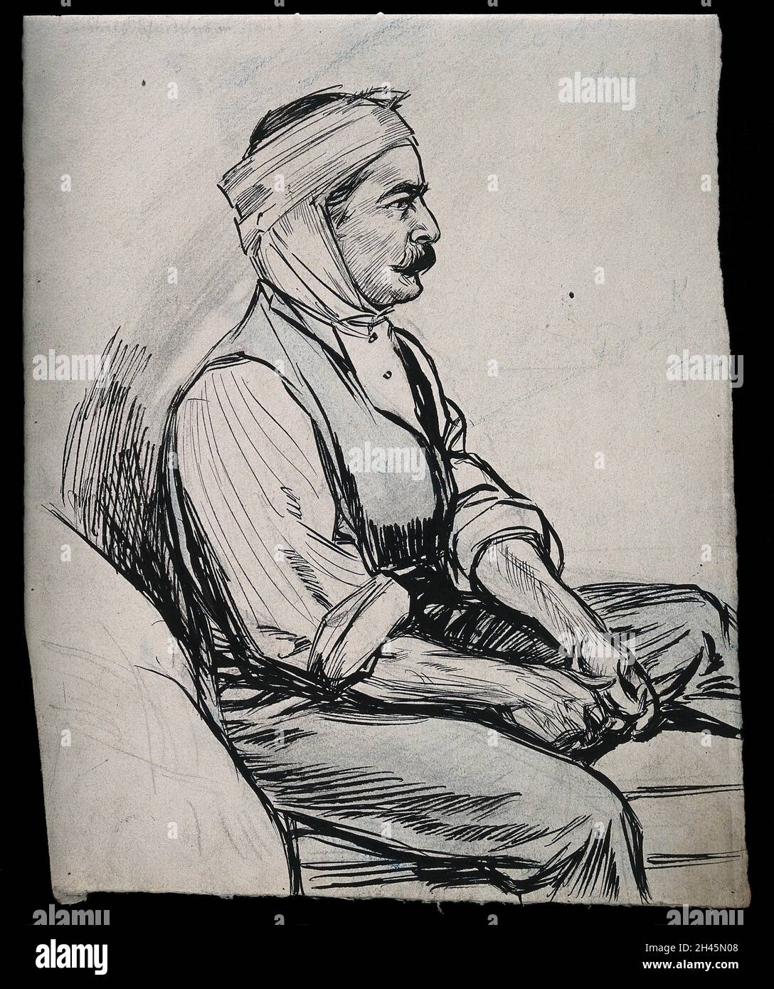 A man with a bandaged head. Pen and ink drawing Stock Photo - Alamy