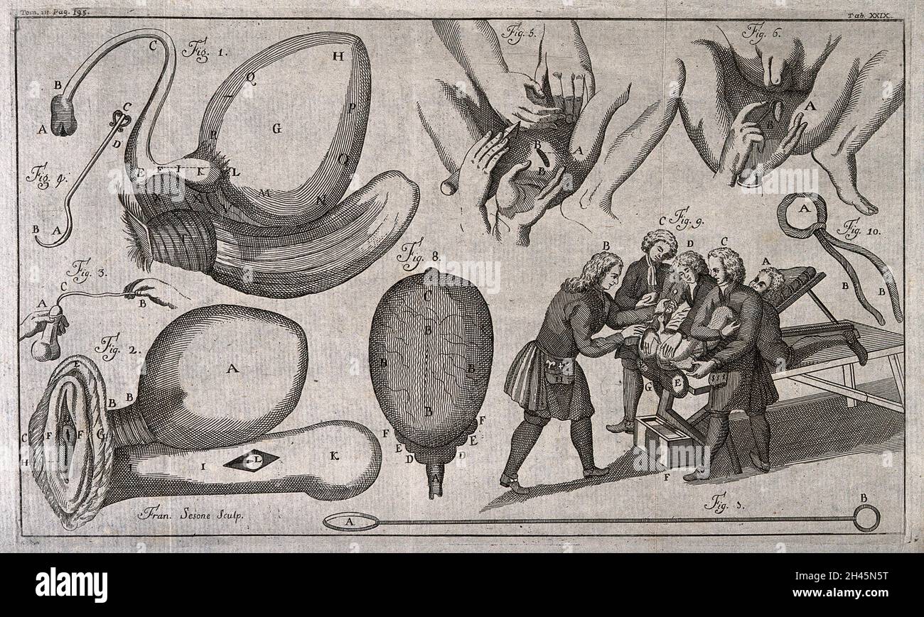 1749 surgery hi-res stock photography and images - Alamy