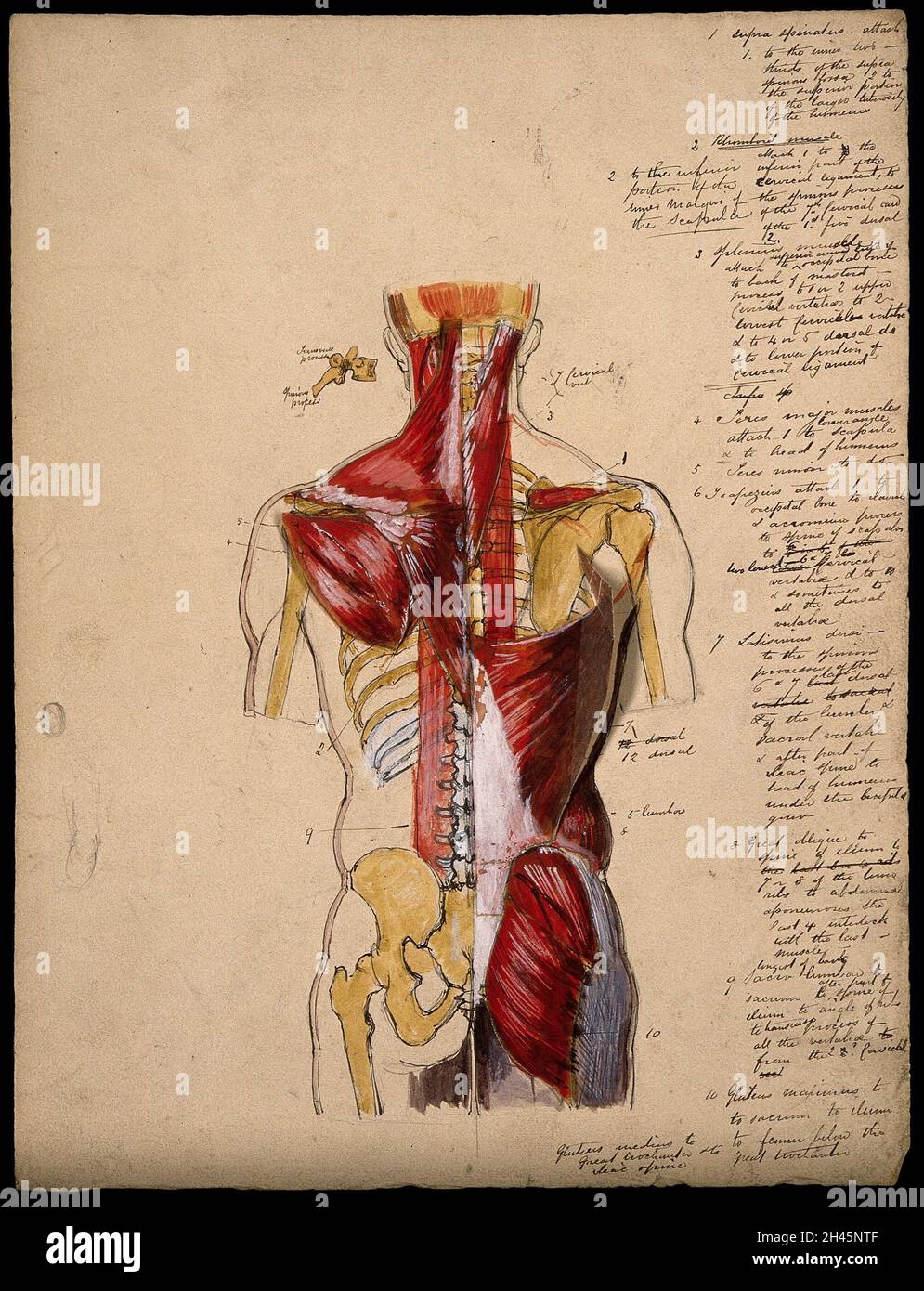 Dissection of the trunk: back view, showing the bones and muscles, with a detail of a vertebra ...