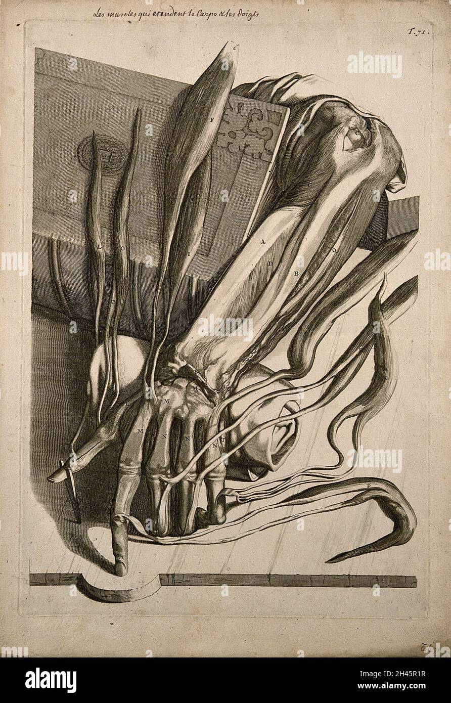 The muscles of the lower arm and hand dissected and spread out across ...
