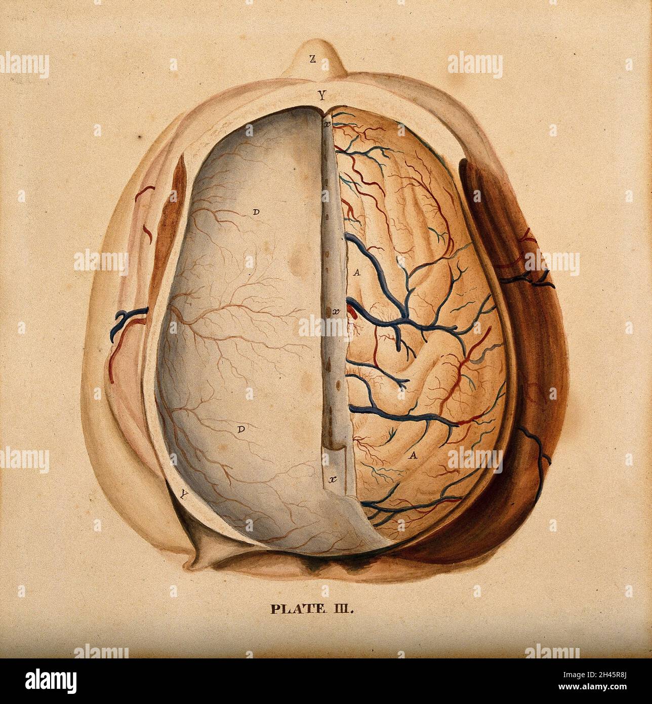 Brain: dissection showing the top of the brain, with the dura mater of ...